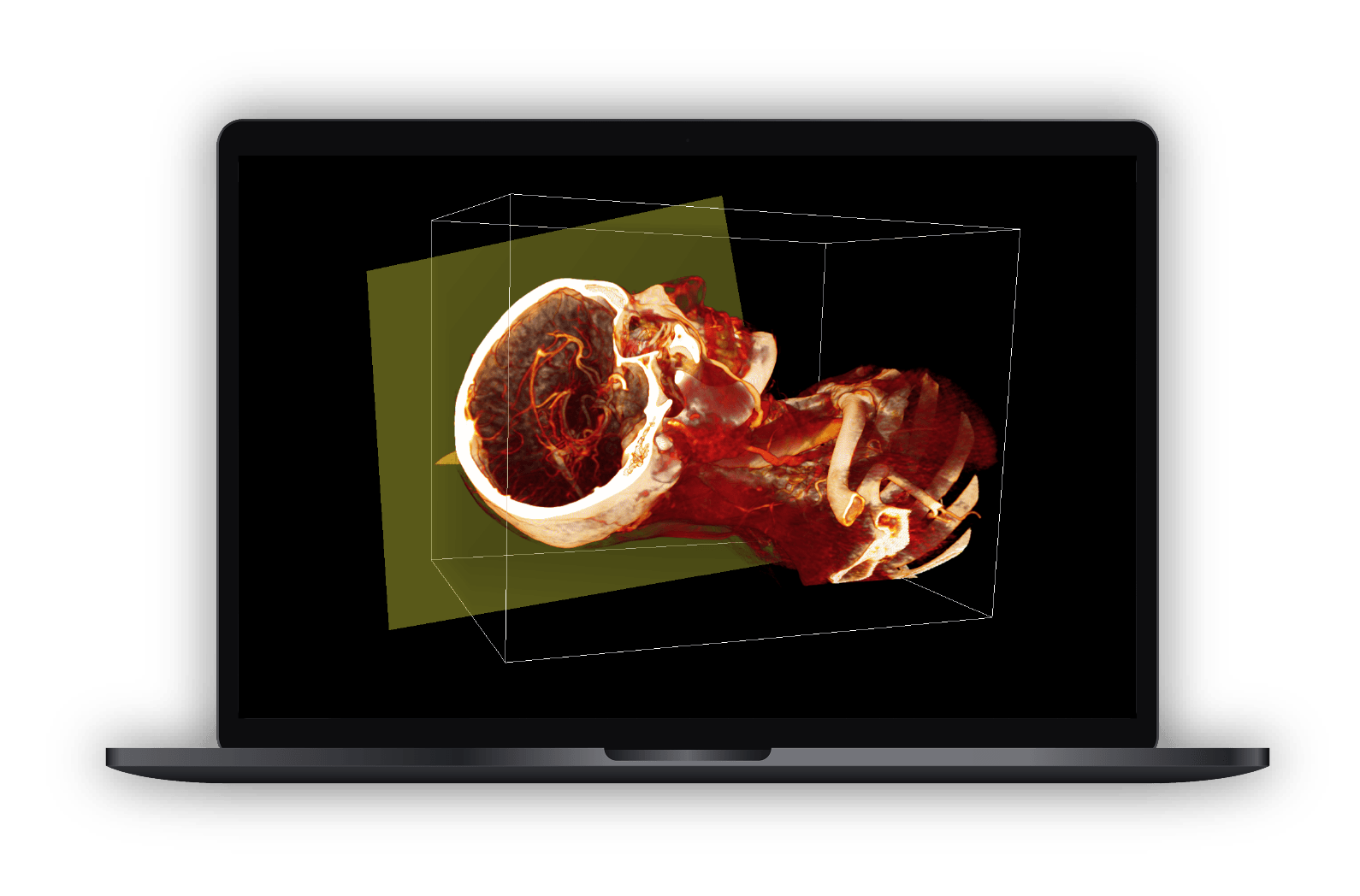 3D Anatomy Software