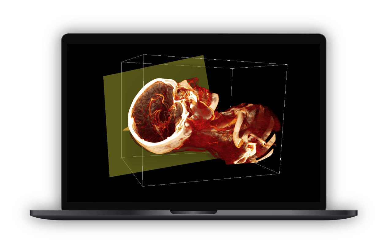 Virtual Anatomy Labs