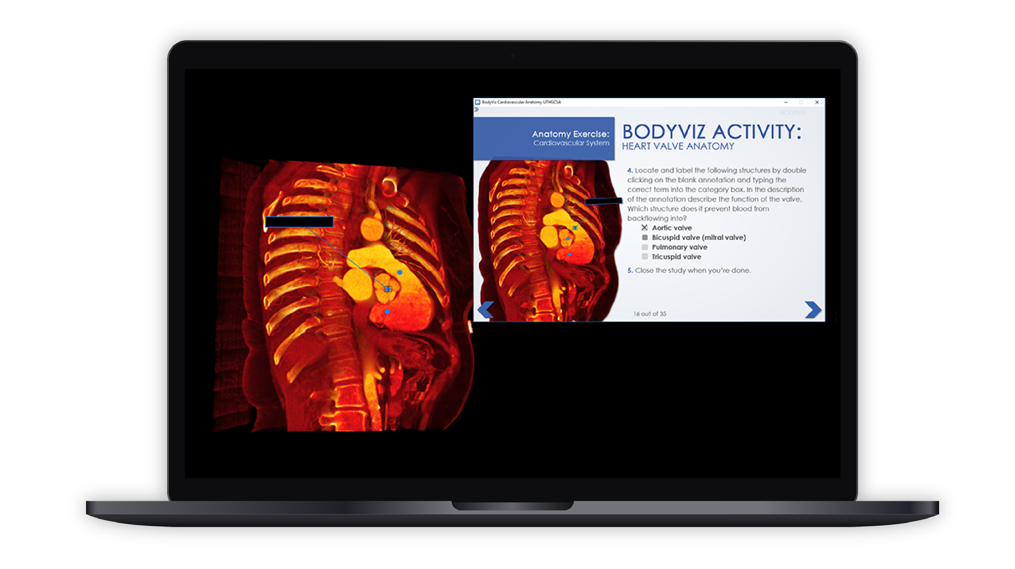 Interactive Anatomy Content